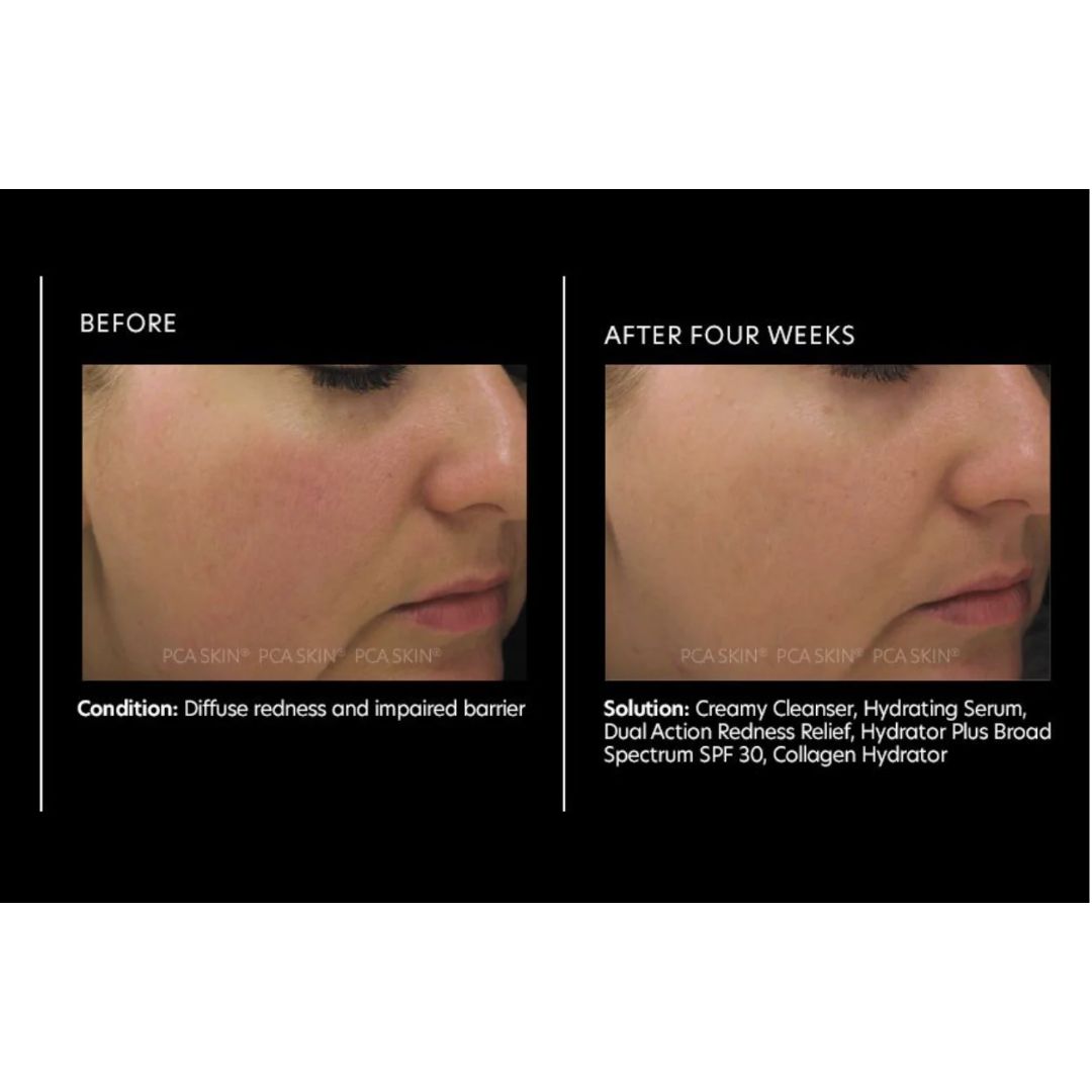 PCA Skin Dual Action Redness Relief 30ml - Free Delivery! - UK