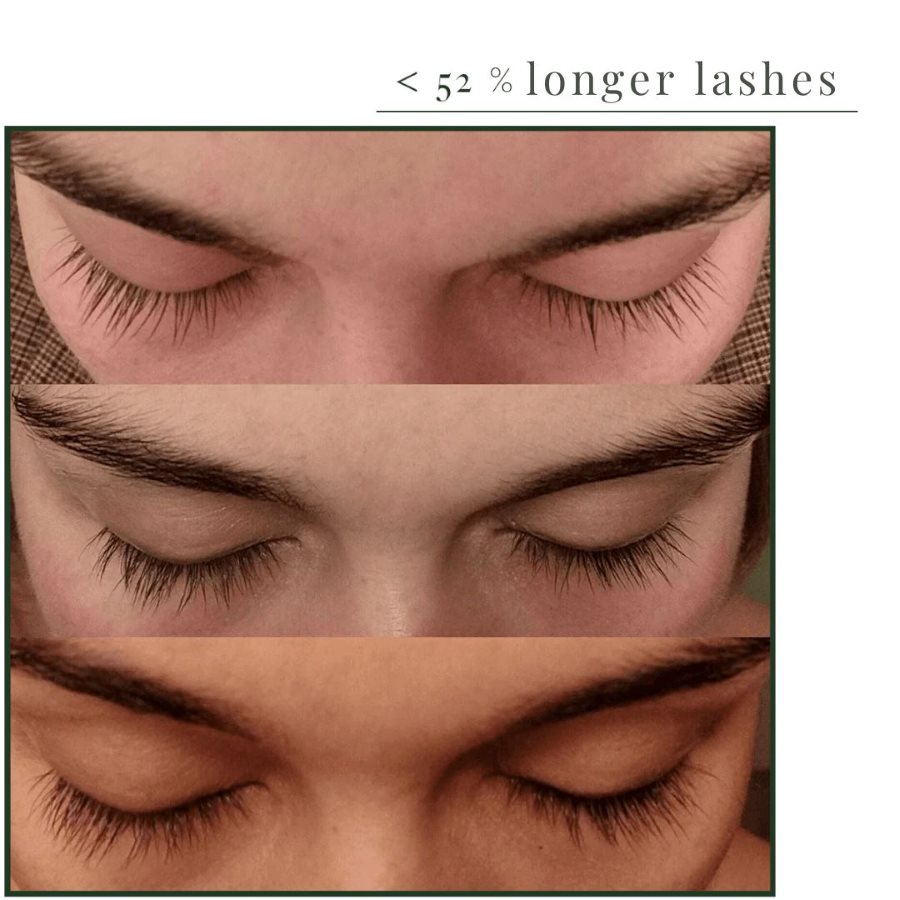 Natucain Lash Serum | Natural Lash Enhancer | Dermoi - UK