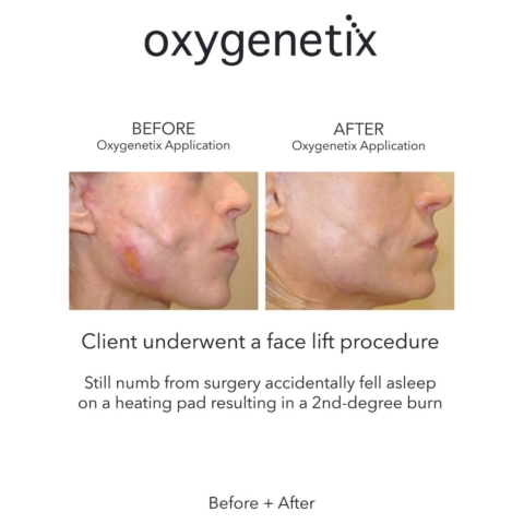 Oxygenetix: Breathable Beauty for Radiant Skin | Dermoi! - UK