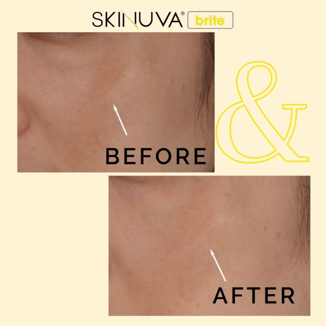 Skinuva Brite - Brightening Cream For Face & Body - UK - UK