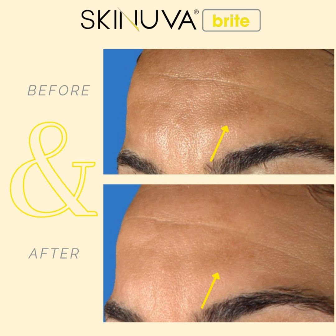 Skinuva Brite - Brightening Cream For Face & Body - UK - UK