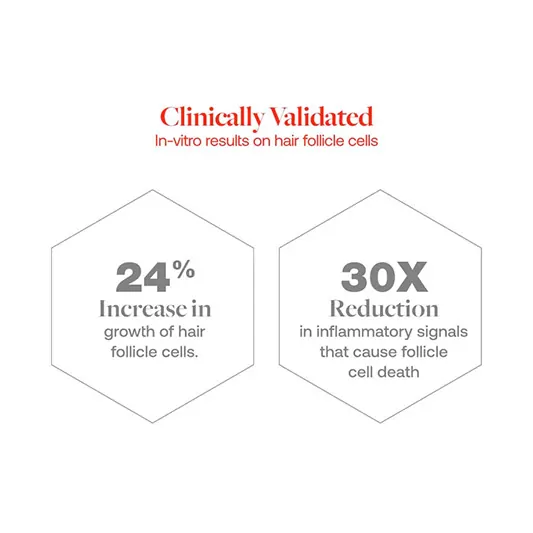 Calecim Professional Advanced Hair System (AHS) - Stem Cells - UK